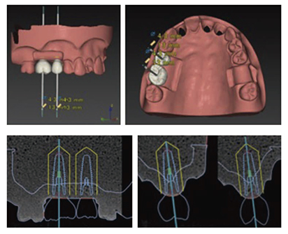 JICD,Vol.5,No.1,e002,2024